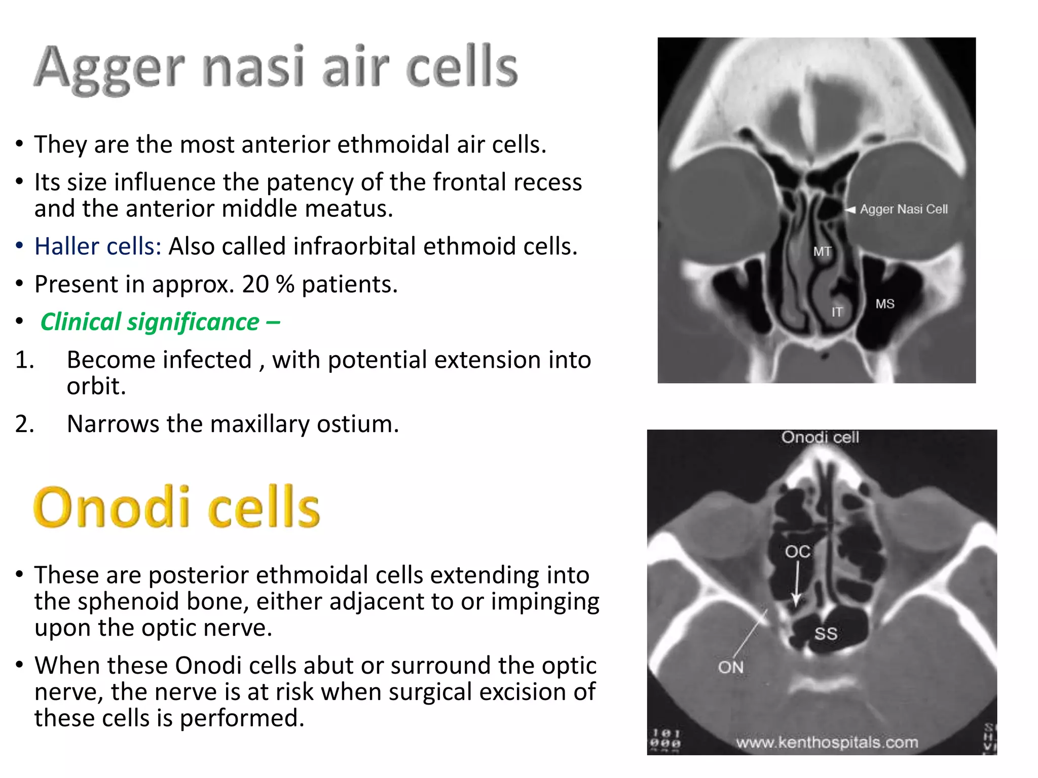 Paranasal sinus diseases and their management | PPTX
