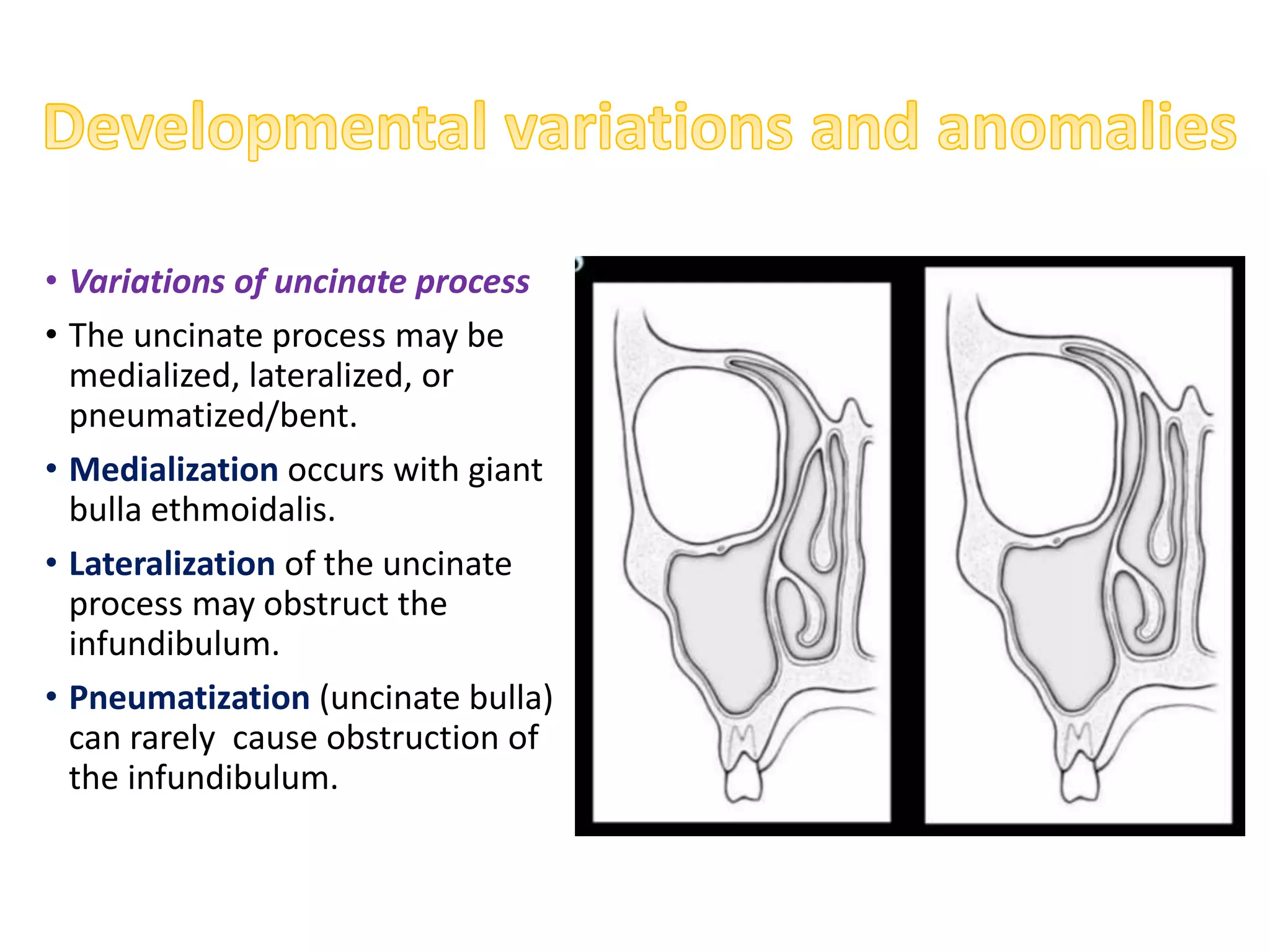 Paranasal sinus diseases and their management | PPTX
