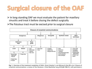 Paranasal sinus diseases and their management | PPTX