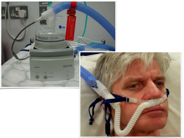 Difficult Airway Society Guidelines Explained | PPTX | First Aid | Injuries