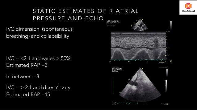 The Echo Doesn't Lie by Murphy