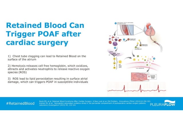 6. Retained Blood Can Trigger POAF After Cardiac Surgery | PPT