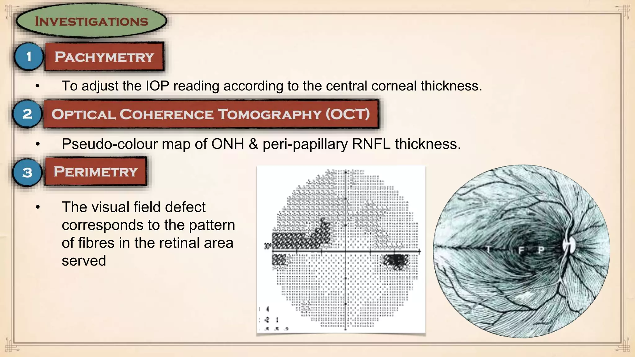 Primary open angle glaucoma | PPTX
