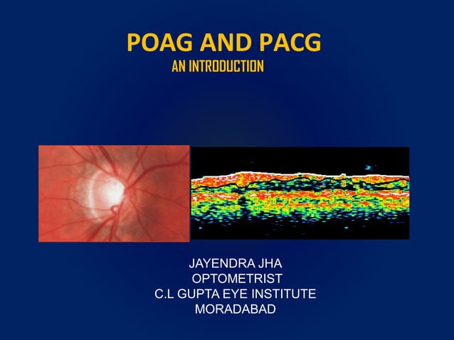 POAG AND PACG | PPT