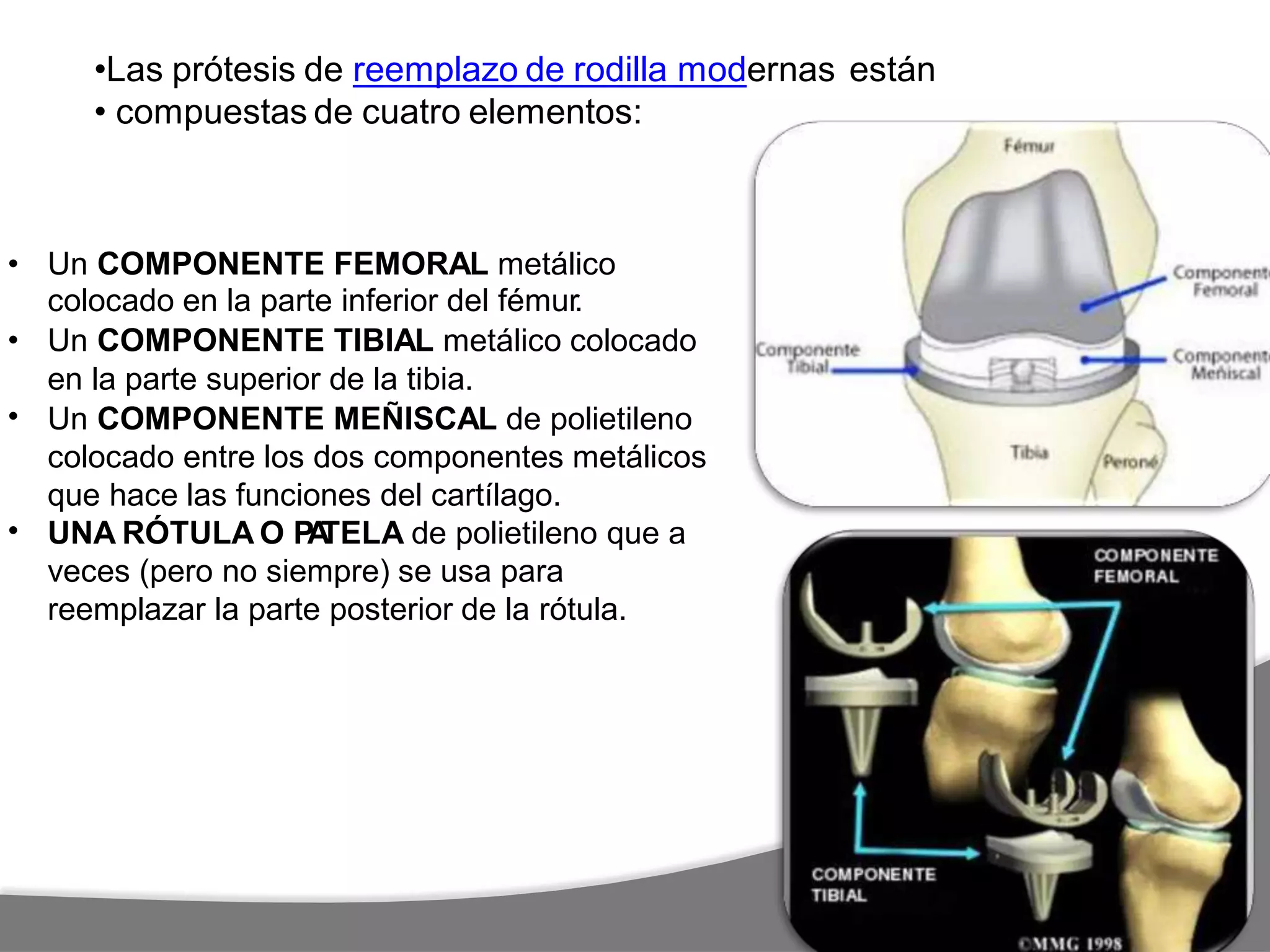 Po cadera y rodilla | PPTX
