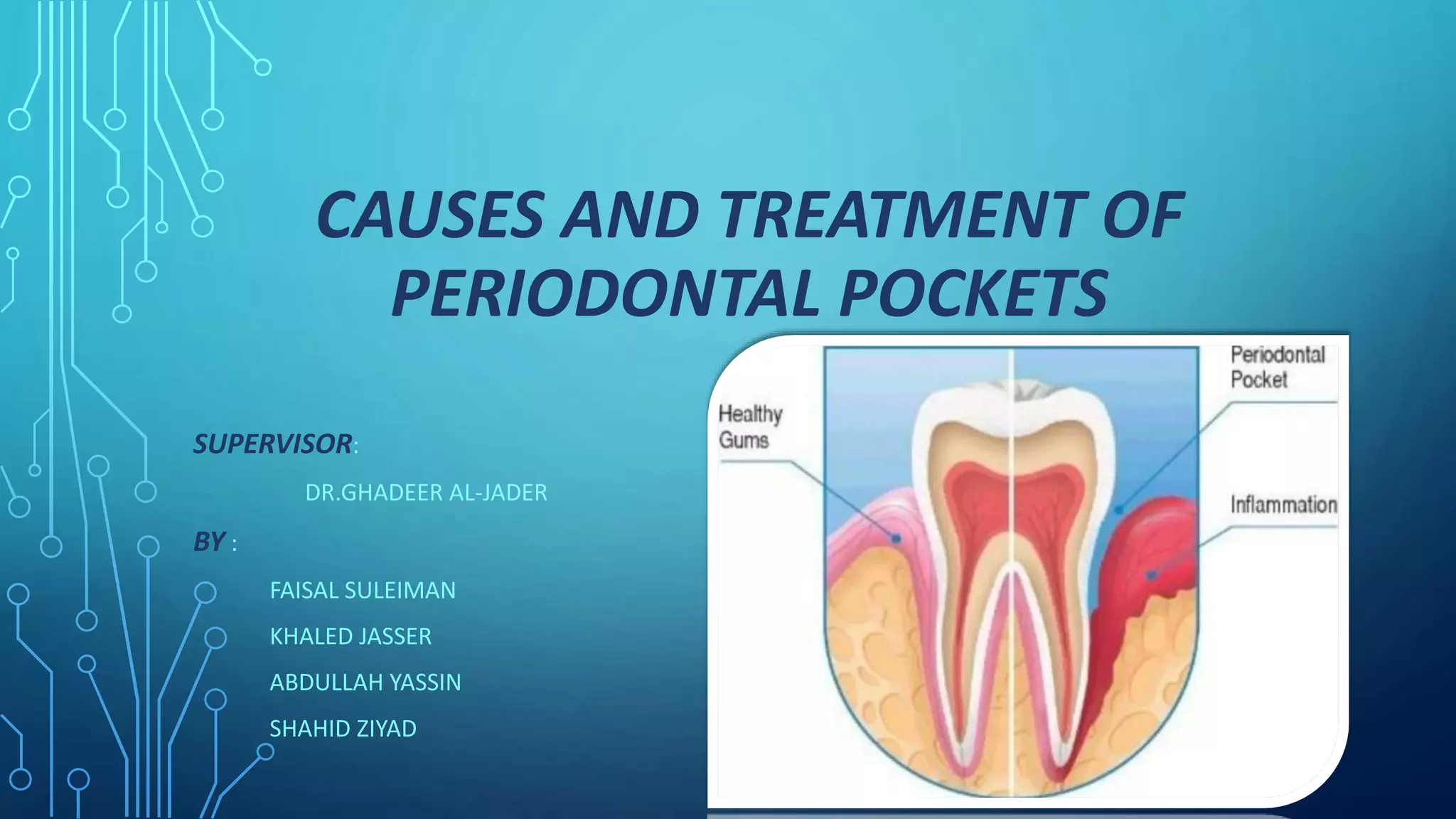 dental pocket | PPTX