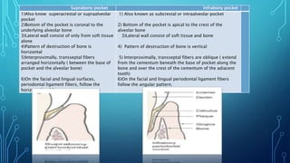 dental pocket | PPTX