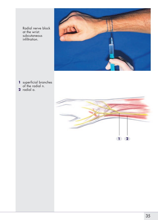 Pocket comp periph nerve blocks.pdf
