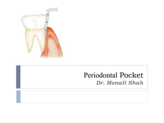 Periodontal Pocket | PPT