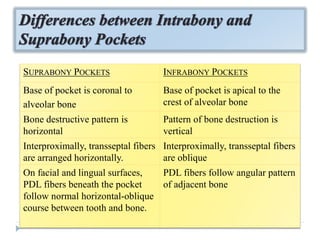 Periodontal Pocket | PPT