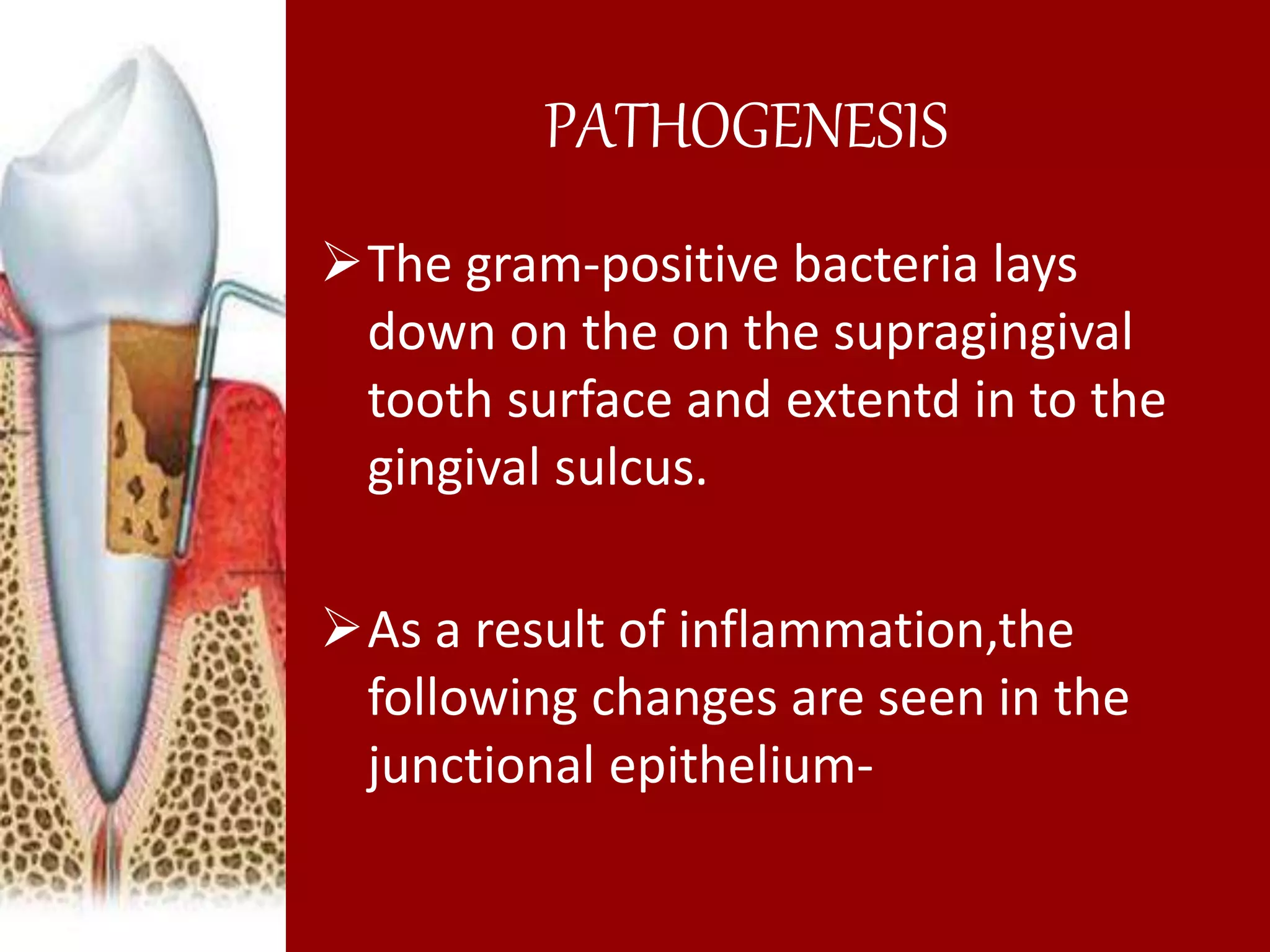 Periodontal Pockets | PPTX
