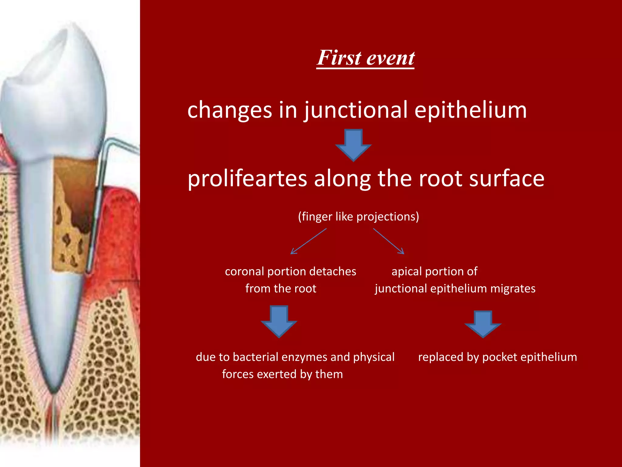 Periodontal Pockets | PPTX