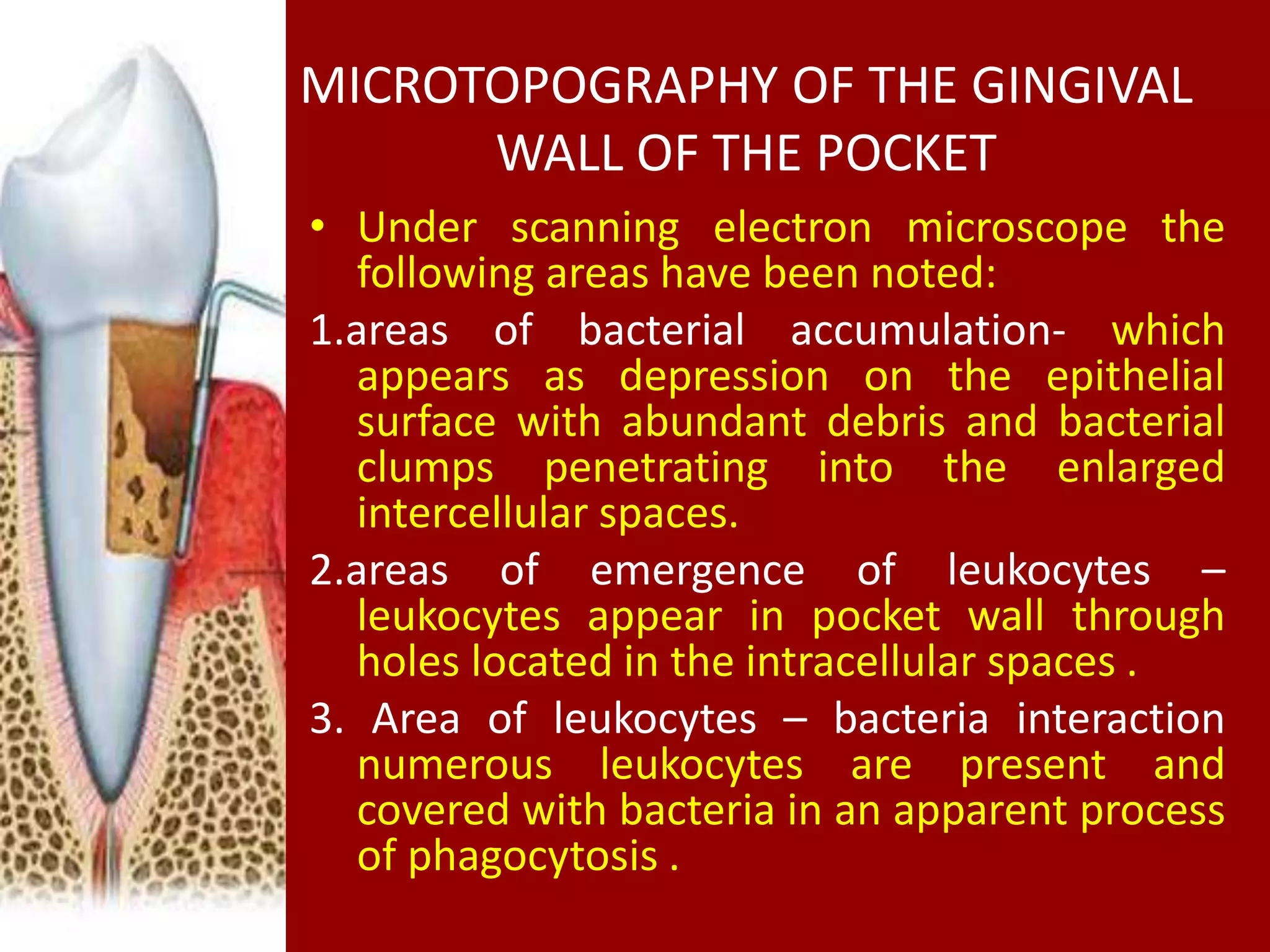 Periodontal Pockets | PPTX