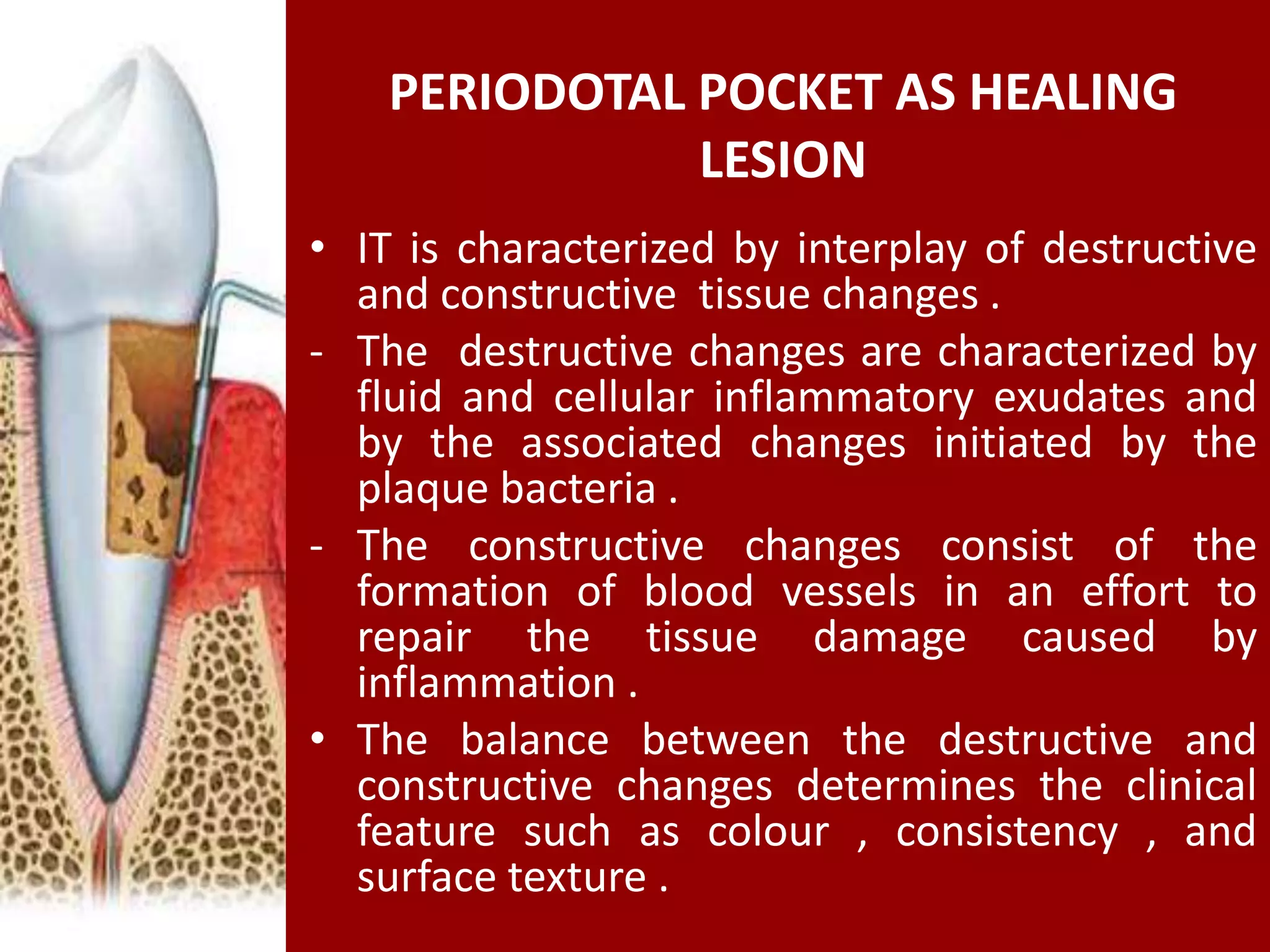 Periodontal Pockets | PPTX