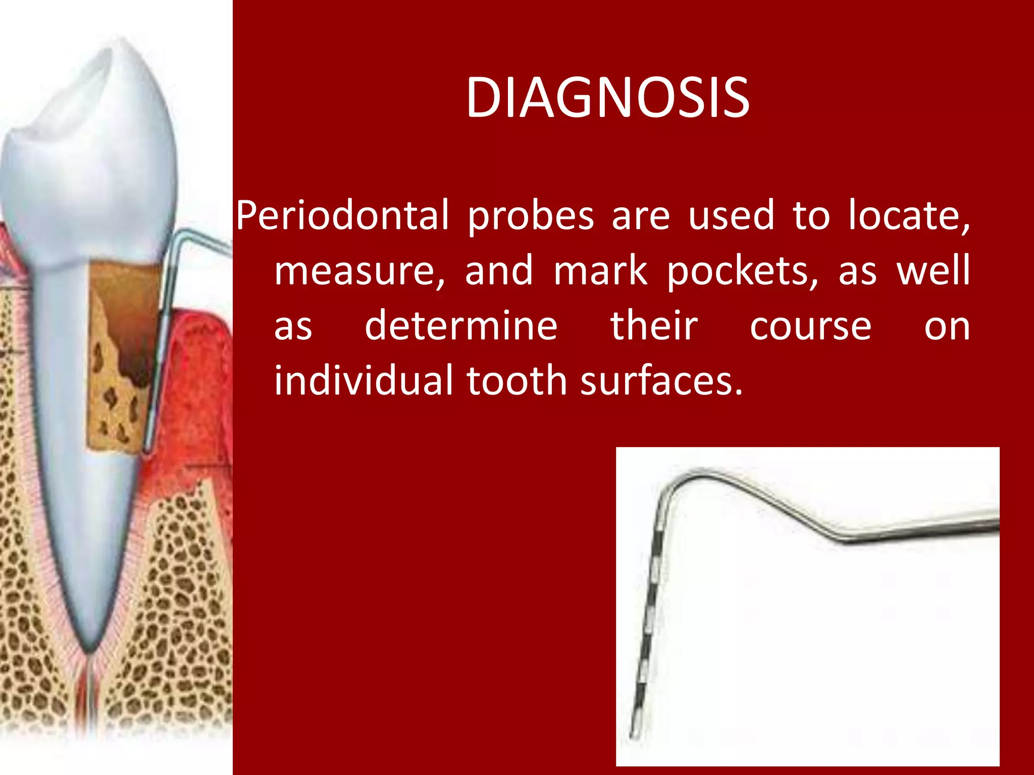 Periodontal Pockets | PPTX