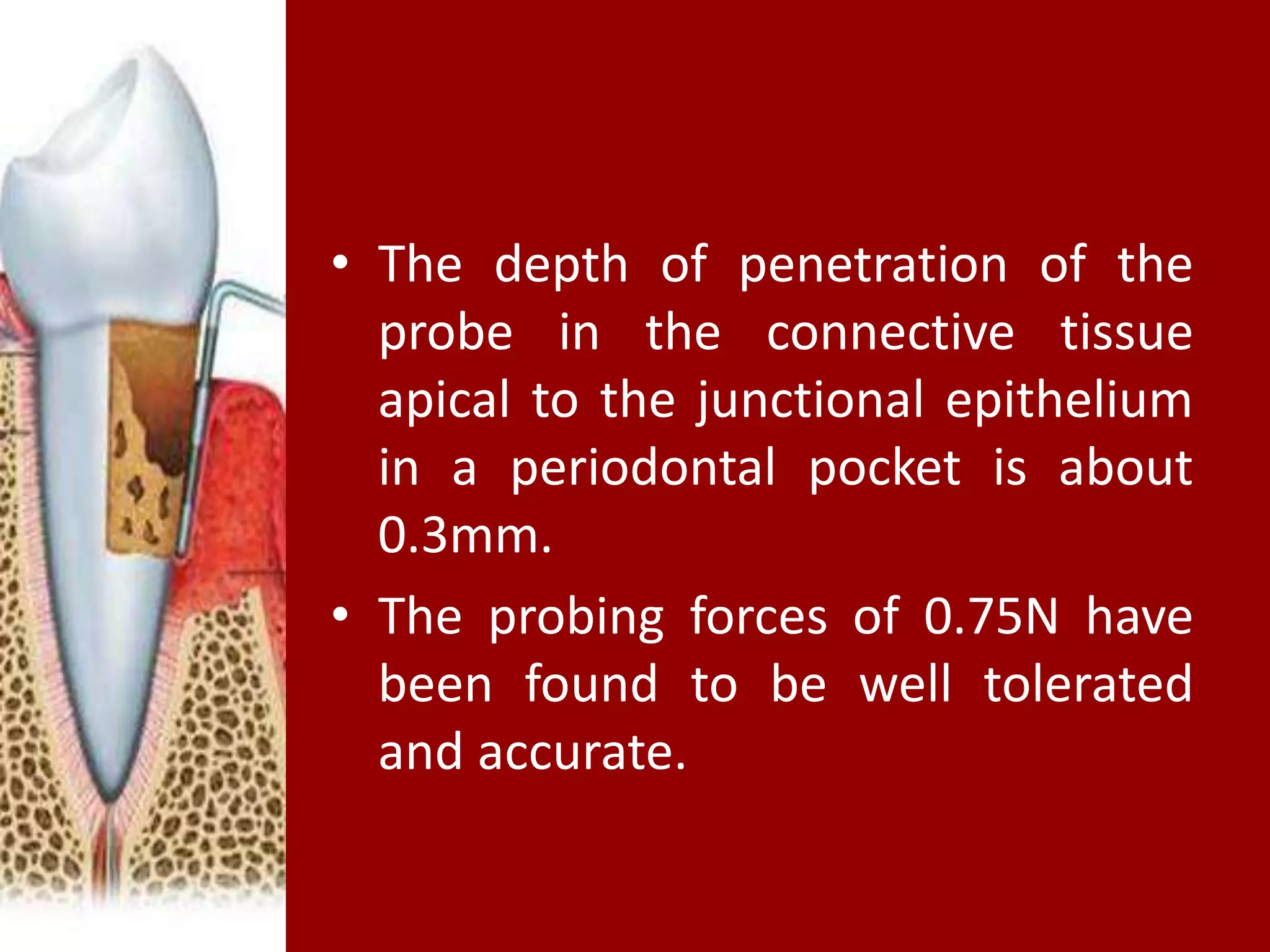 Periodontal Pockets | PPTX