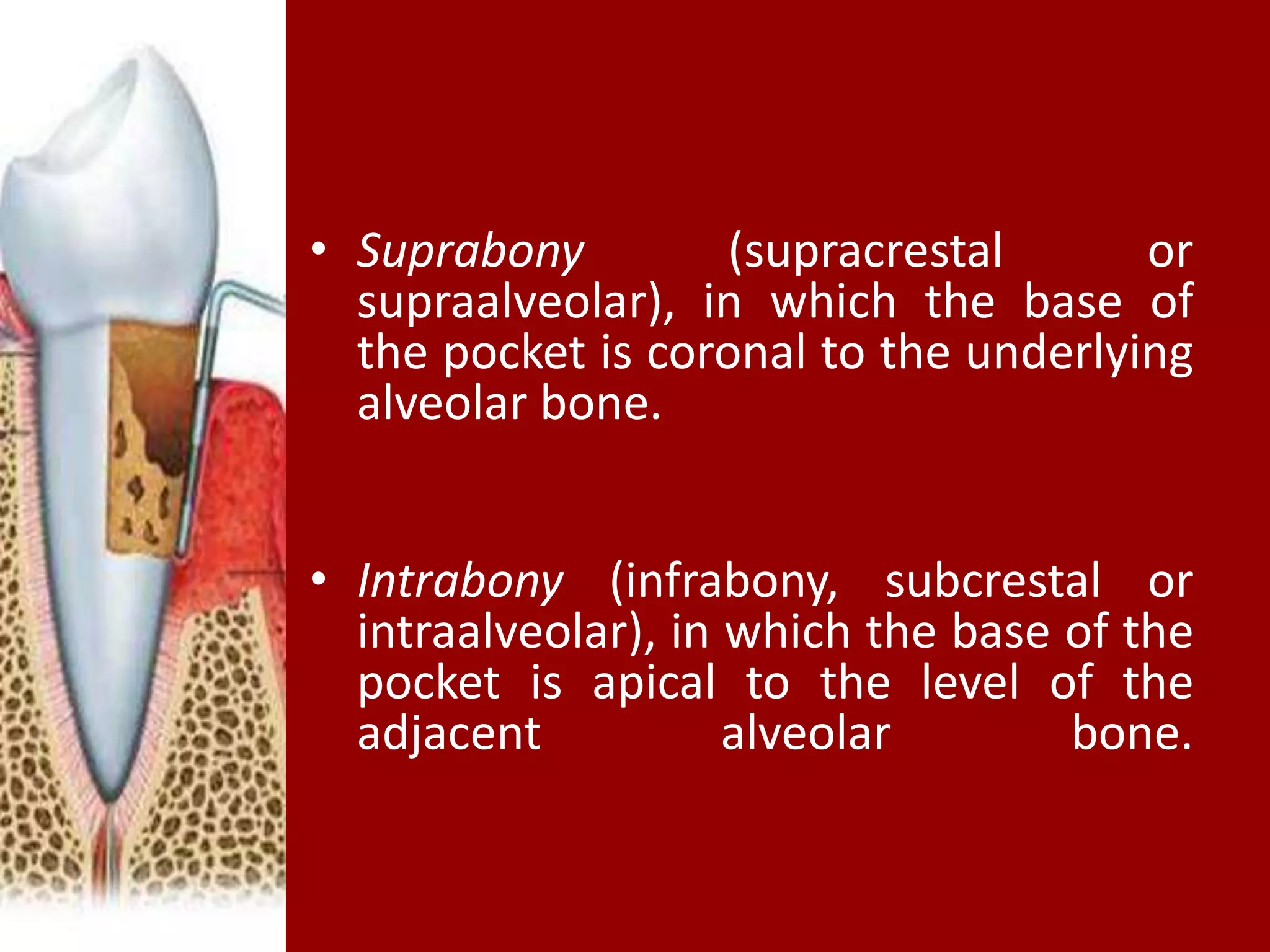 Periodontal Pockets | PPTX