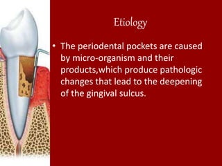 Periodontal Pockets | PPTX