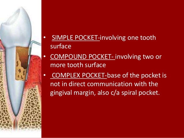 Periodontal Pockets