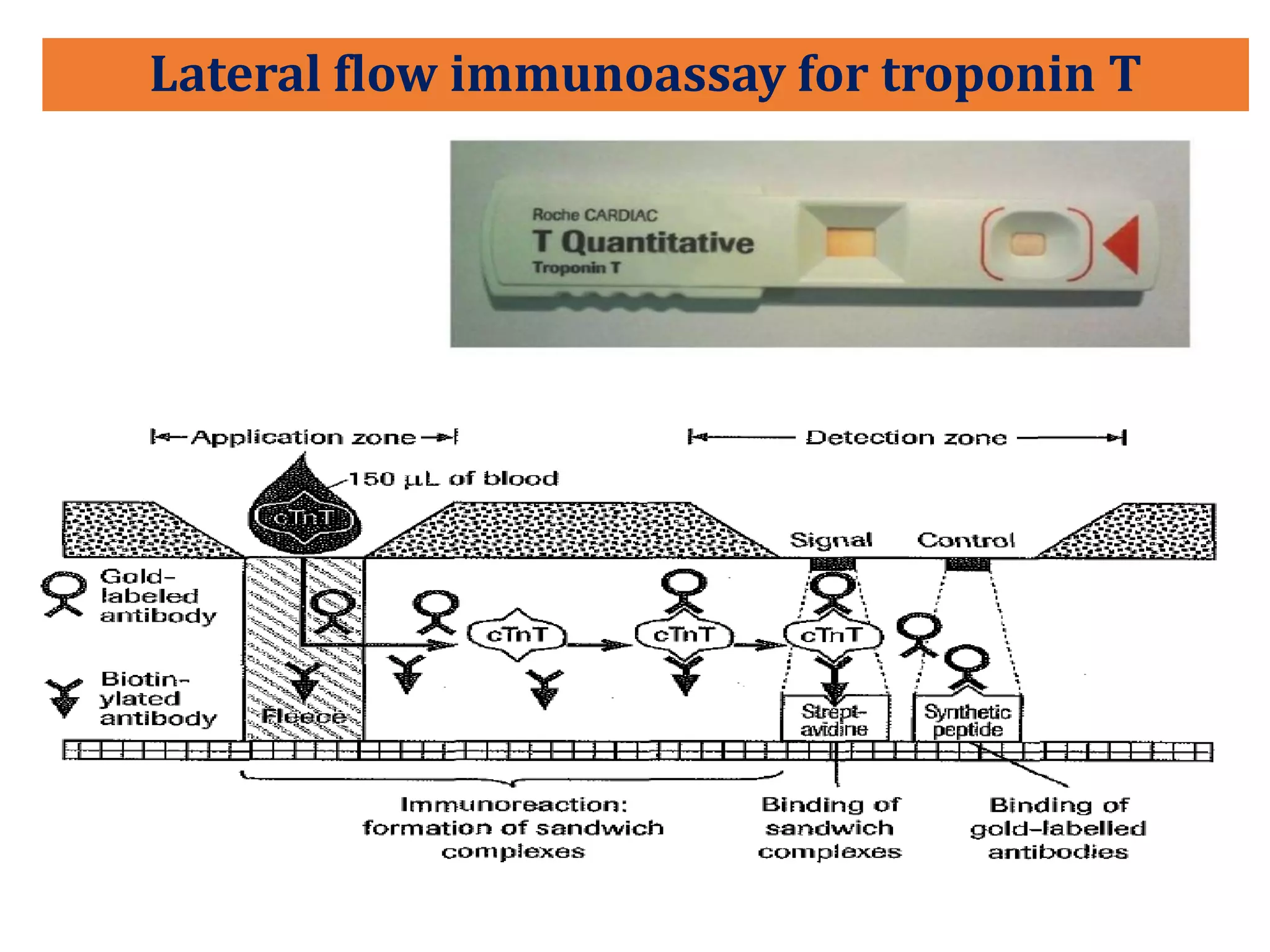 Point of care testing ( POCT) | PDF
