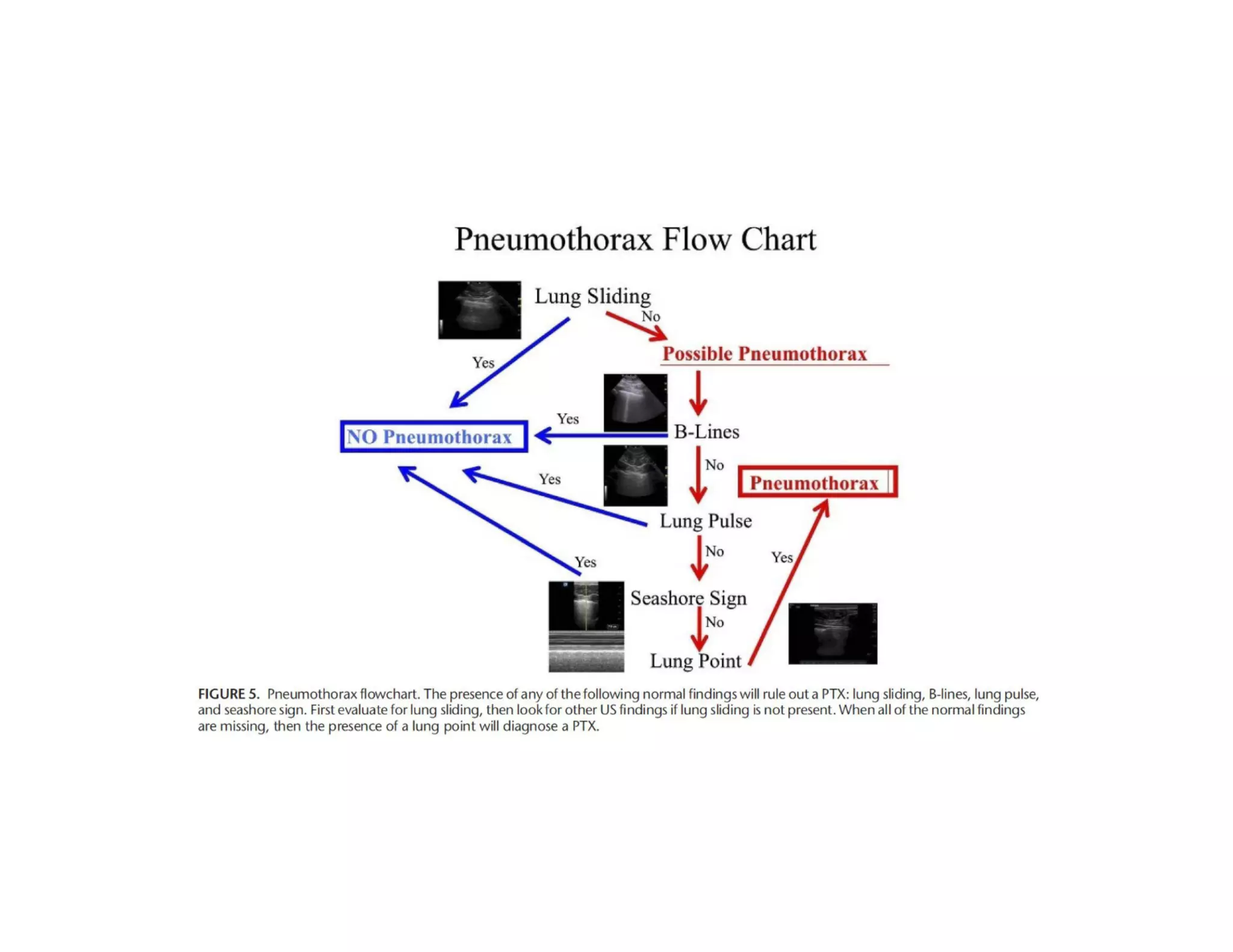 POCUS | PDF