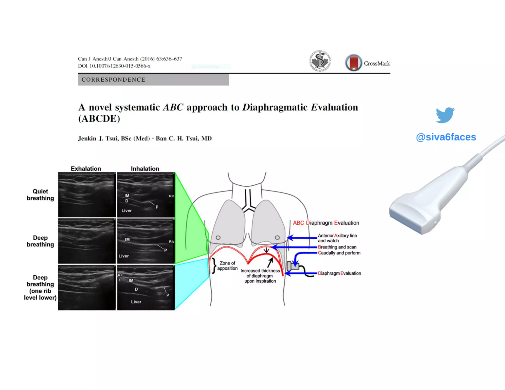 POCUS | PDF