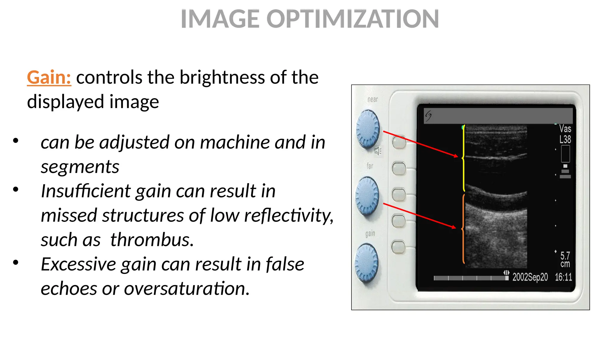 Point of Care Ultrasound- Basic of USG in POCUS.pptx