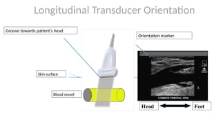 Point of Care Ultrasound- Basic of USG in POCUS.pptx
