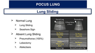 POCUS -Neonatal Ultrasound Images for knowledge | PPTX