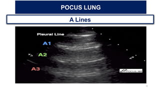 POCUS -Neonatal Ultrasound Images for knowledge | PPTX
