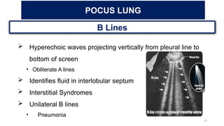 POCUS -Neonatal Ultrasound Images for knowledge | PPTX