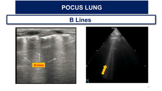 POCUS -Neonatal Ultrasound Images for knowledge | PPTX