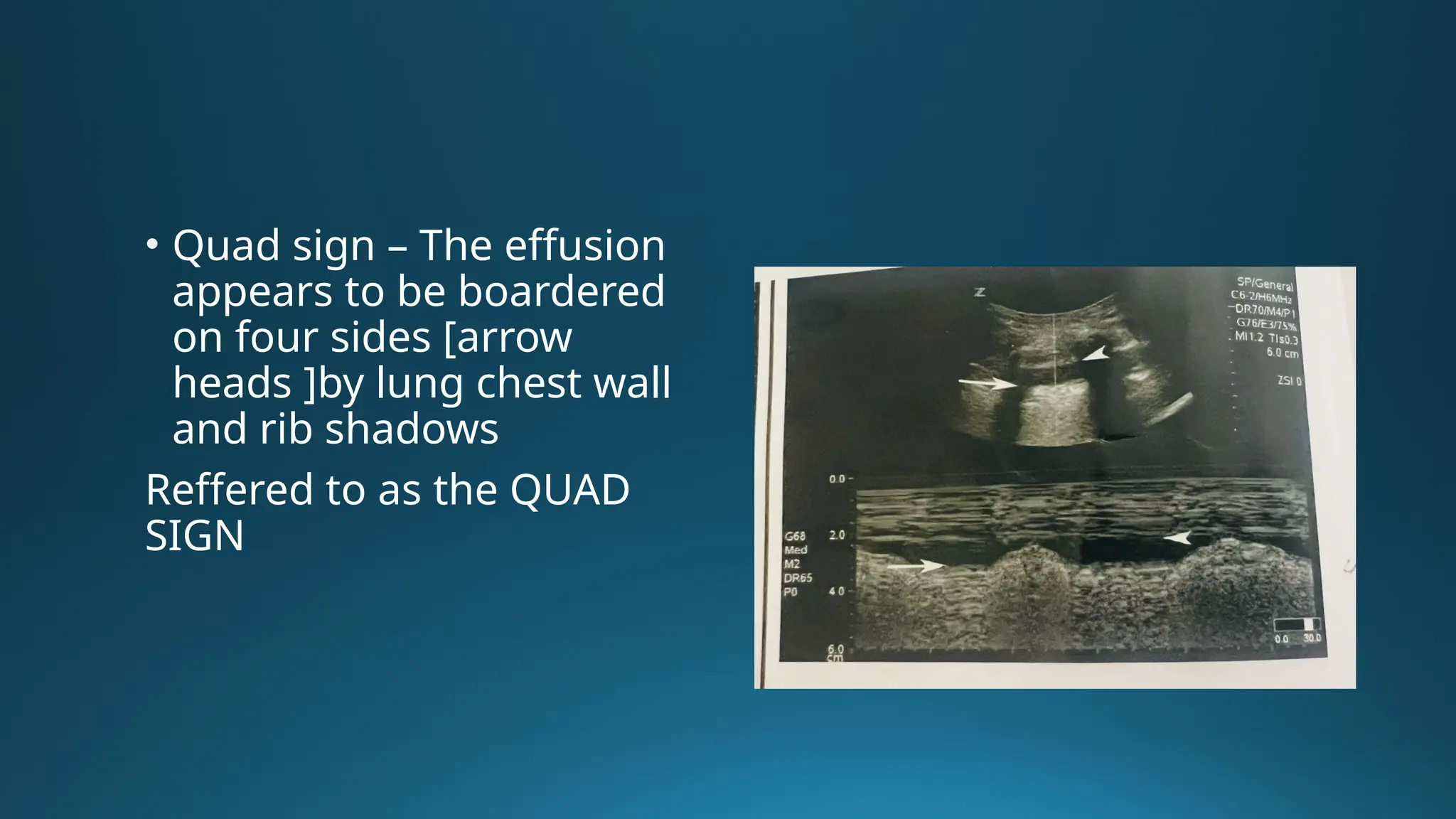 Pocus-point of care ultrasound is a portable ultrasound machine that ...