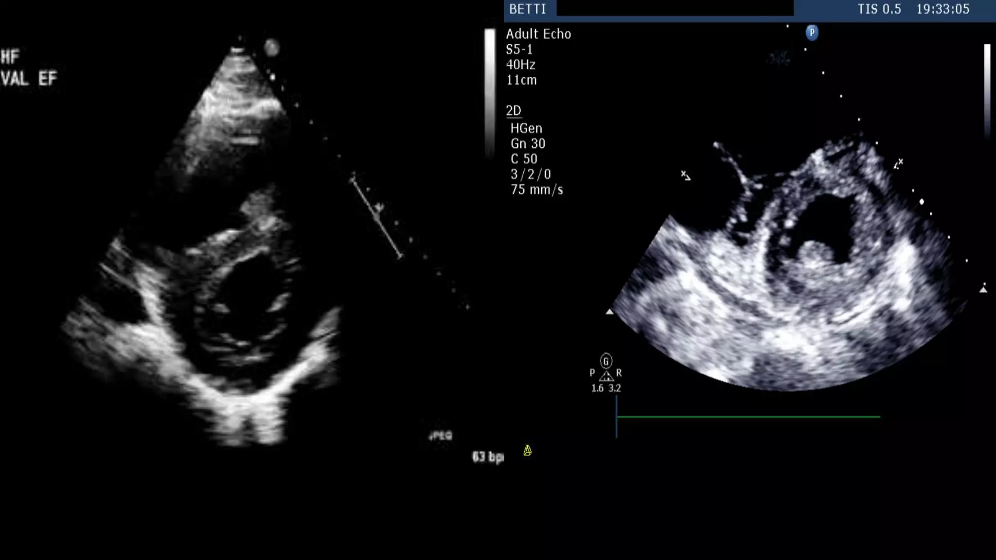 Pocus and deresuscitation | PPTX