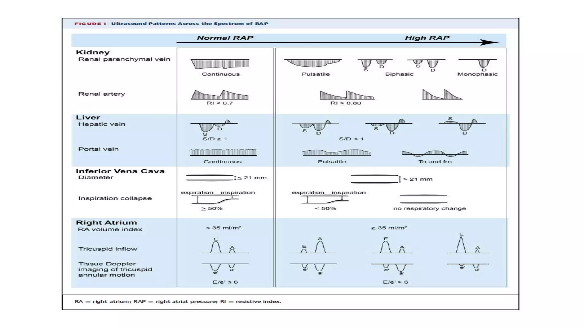 Pocus and deresuscitation | PPTX