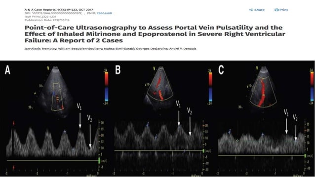 Pocus and deresuscitation | PPTX