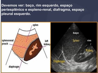 Protocolo FAST POCUS | PDF