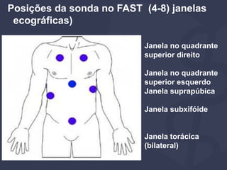 Protocolo FAST POCUS | PDF