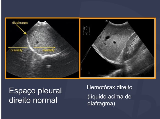 Protocolo FAST POCUS