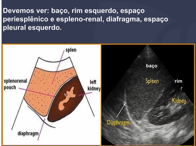 Protocolo FAST POCUS