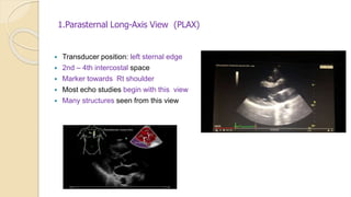 POCUS for Residents of Anesthesia and Critical care | PPTX