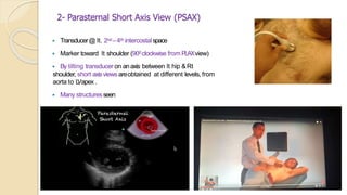 POCUS for Residents of Anesthesia and Critical care | PPTX
