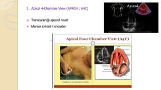 POCUS for Residents of Anesthesia and Critical care | PPTX
