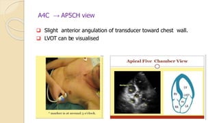 POCUS for Residents of Anesthesia and Critical care | PPTX