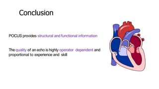 POCUS for Residents of Anesthesia and Critical care | PPTX
