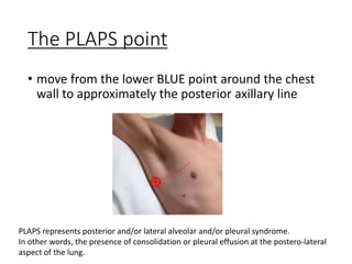 POCUS for dyspnea.pptx