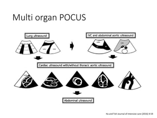 POCUS for dyspnea.pptx