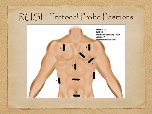 Point of Care Cardiac U/S
