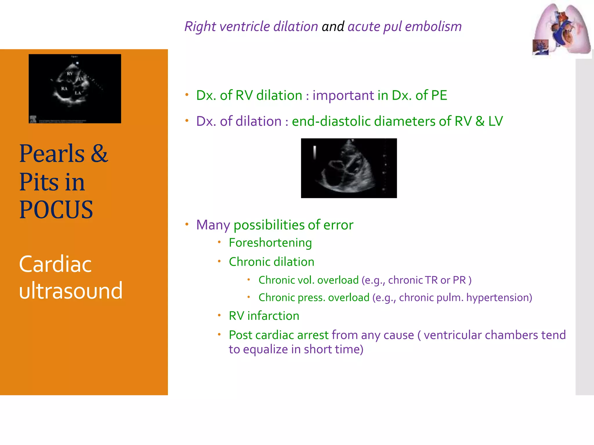 POCUS in critical care Jan 8th 2020 Teh Iran | PPTX