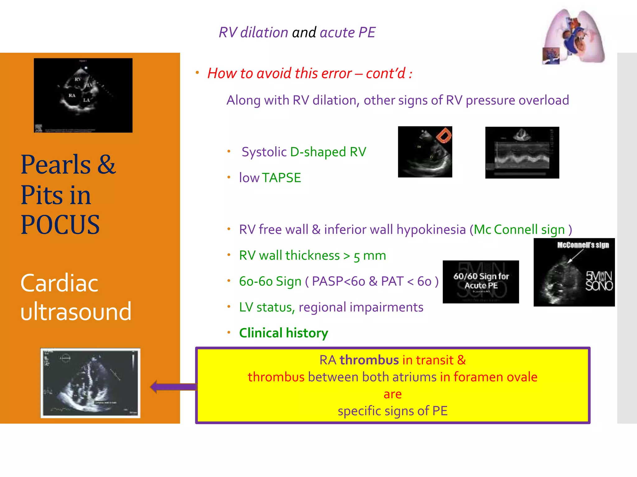 POCUS in critical care Jan 8th 2020 Teh Iran | PPTX